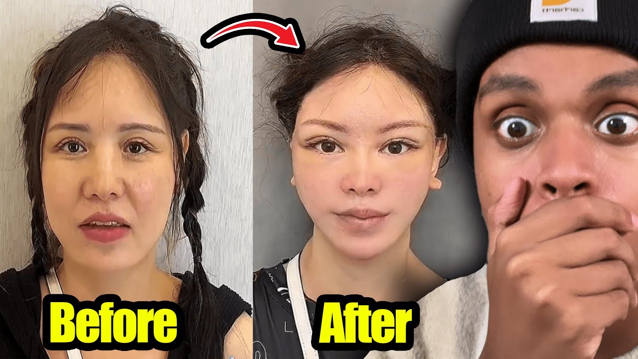 The Tiktok Surgeon That S Ruining People S Lives Youtube