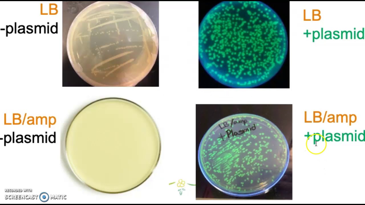 Pglo Transformation Lab Solved Please Help Me Answer The Questions