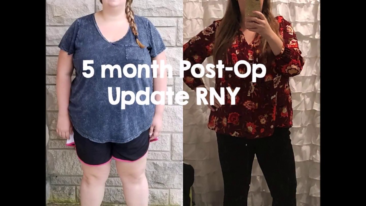 5 Month Post Op Update Low Carb Life Refocused For 2018 Youtube