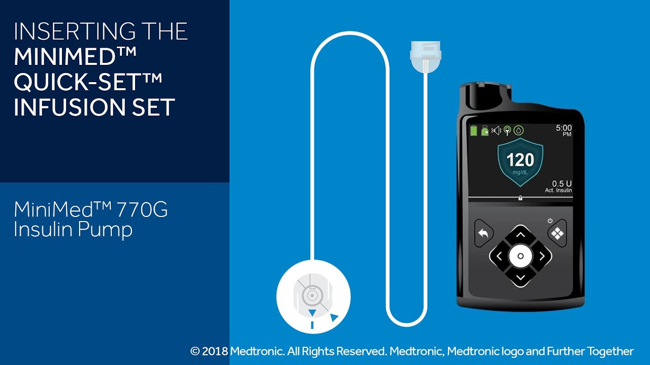 Inserting The Quick Set Infusion Set With The Minimed邃 770g System