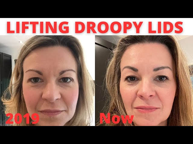 Hooded Eyelids Vs Double Eyelids Reddit Infoupdate Org