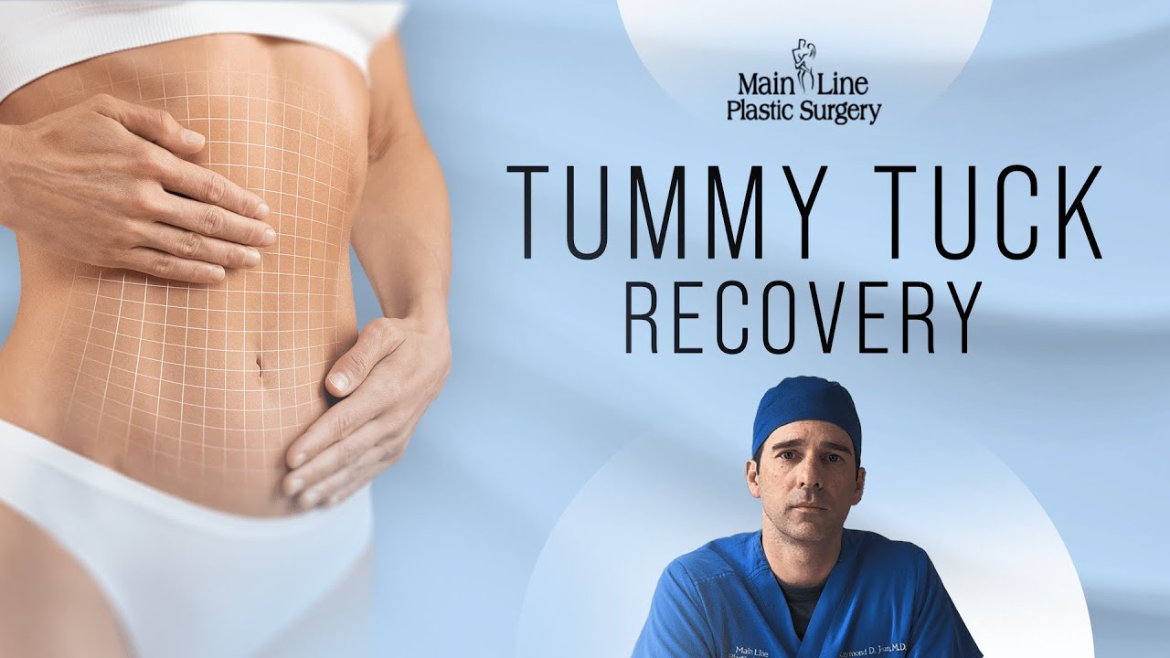 Tummy Tuck Recovery What To Expect After Surgery Youtube