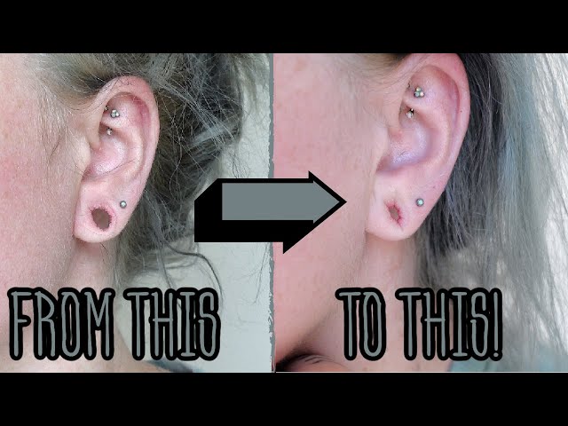 Small Stretched Earlobes
