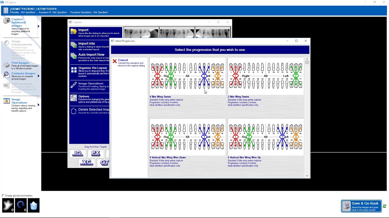 Training Apteryx Xrayvision Dcv Importing Images Youtube