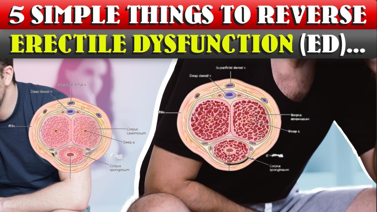 5 Simple Things To Reverse Erectile Dysfunction Ed Awesome Facts