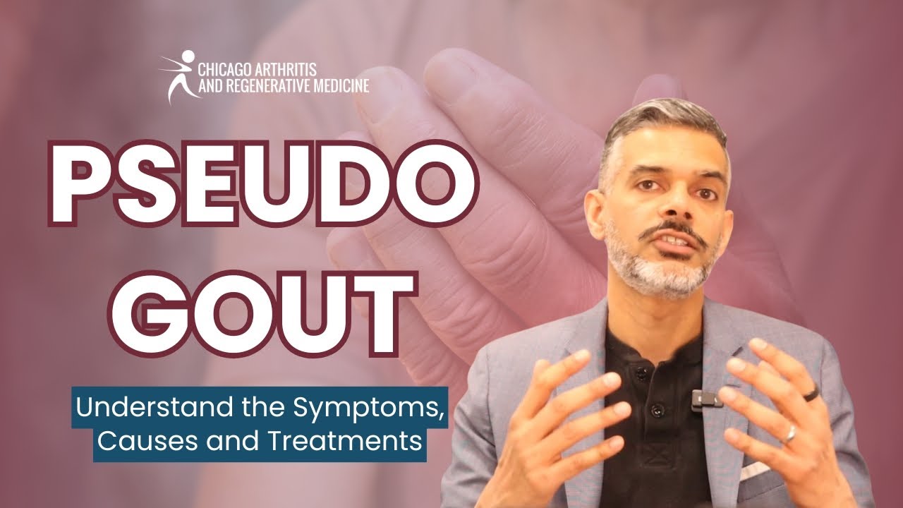 How To Treat Pseudogout Cppd Crystals Effectively Youtube