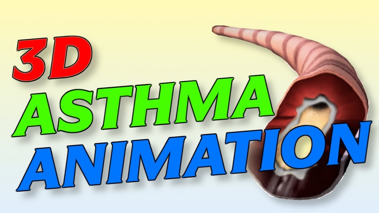 3d Asthma Medical Animation Symptoms Causes And Modern Treatment