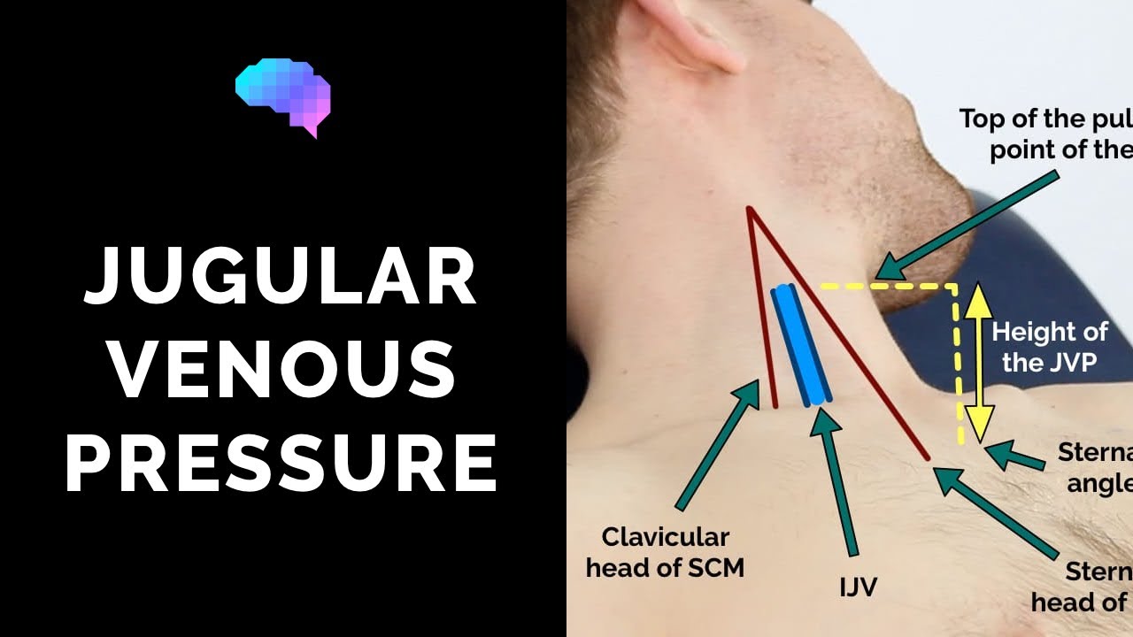 Measuring Jugular Venous Pressure Jvp Osce Guide Clip Ukmla