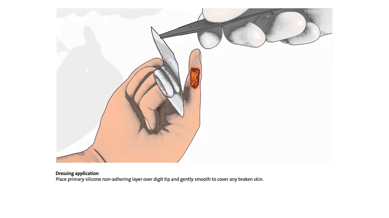 Adaptic邃 Digit How To Use Video Youtube