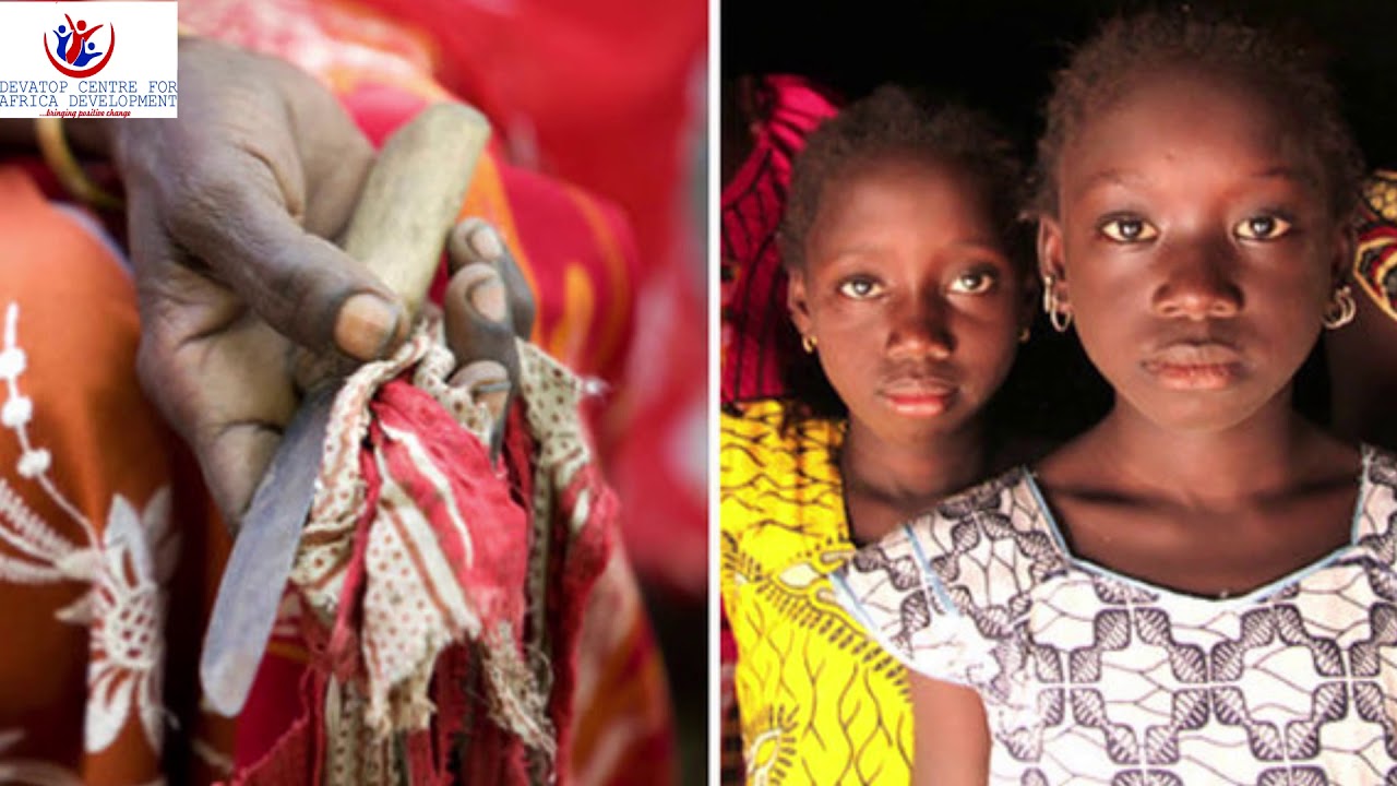 Fgm