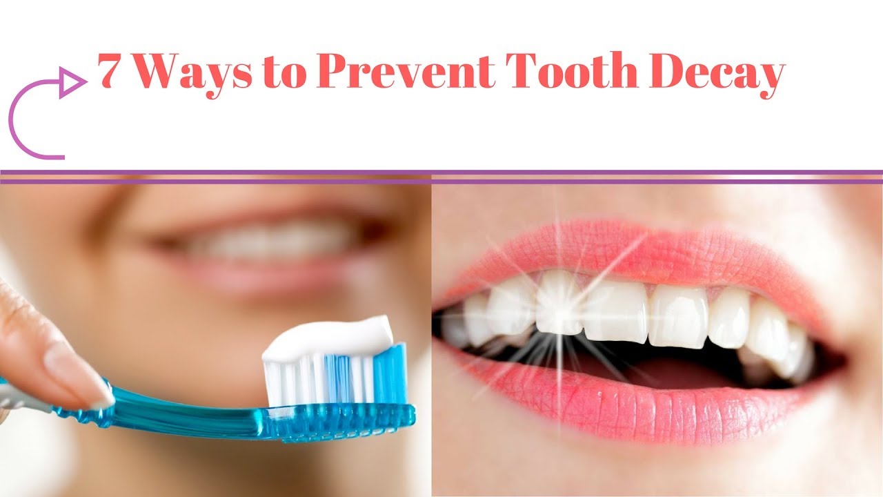 How To Reduce Teeth Spots At Elsie Tucker Blog