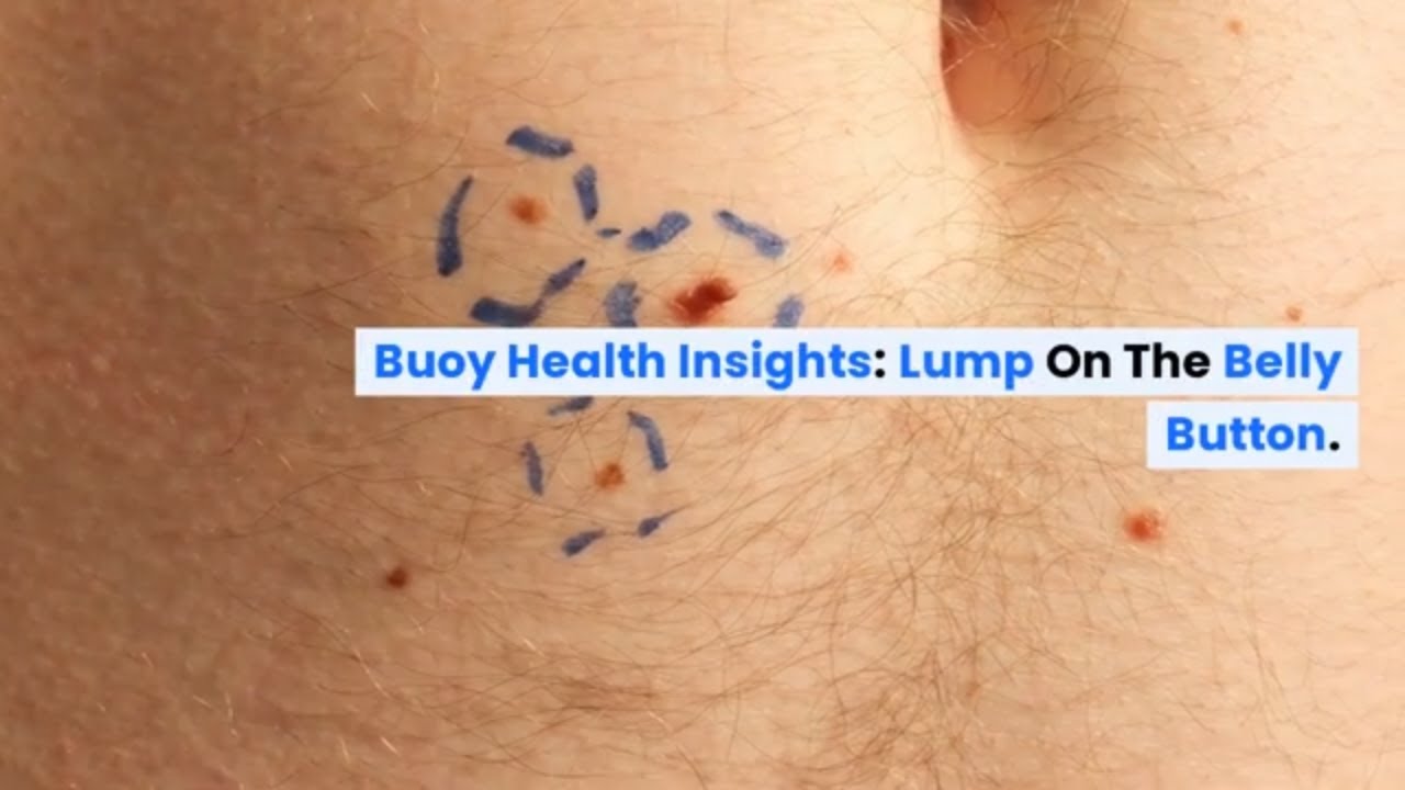 Lump On The Belly Button Common Causes And When To Seek Medical Care