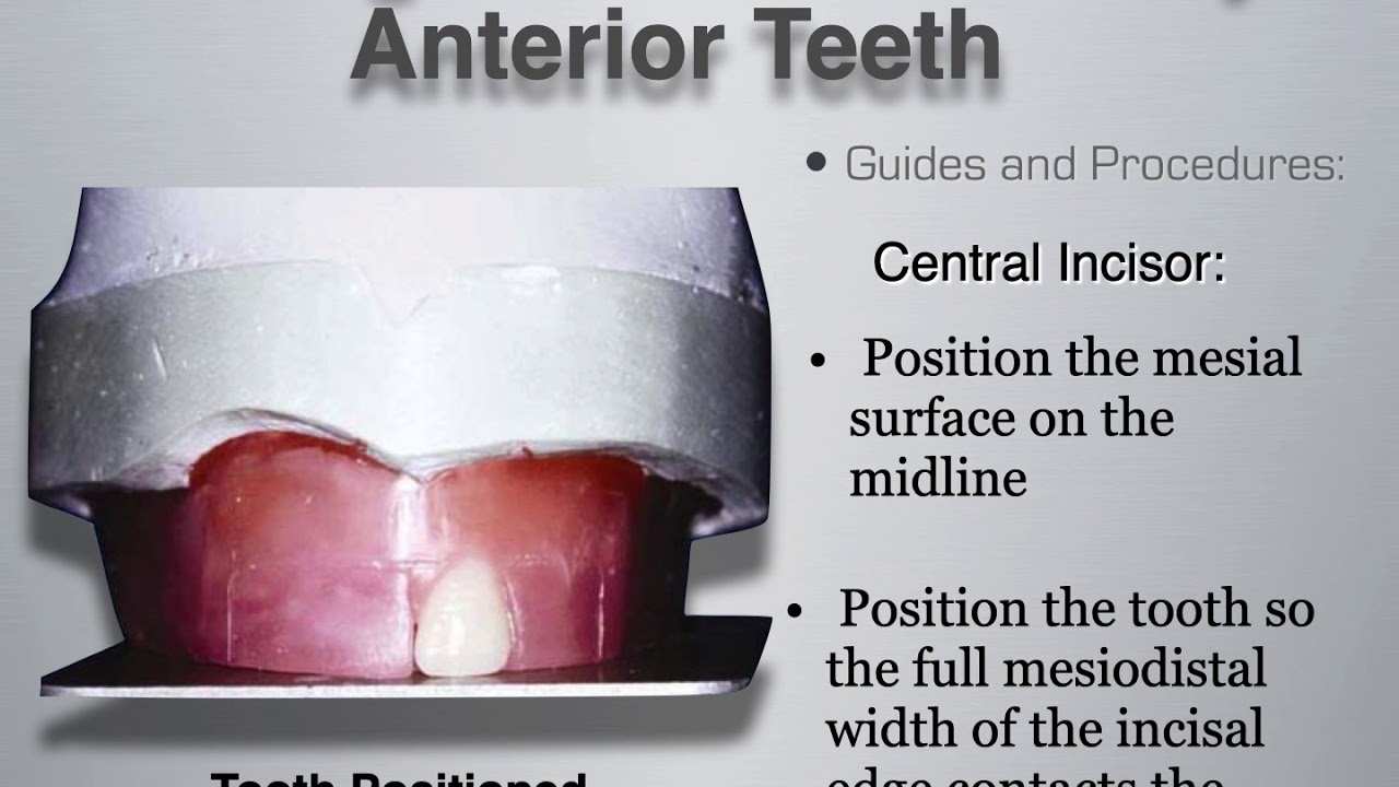 Complete Dentures 1 8 Anterior Setup Youtube