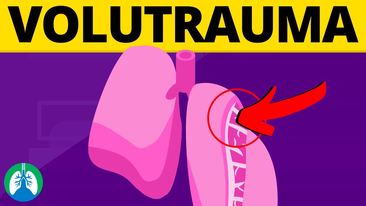 Volutrauma Medical Definition Quick Explainer Video Youtube