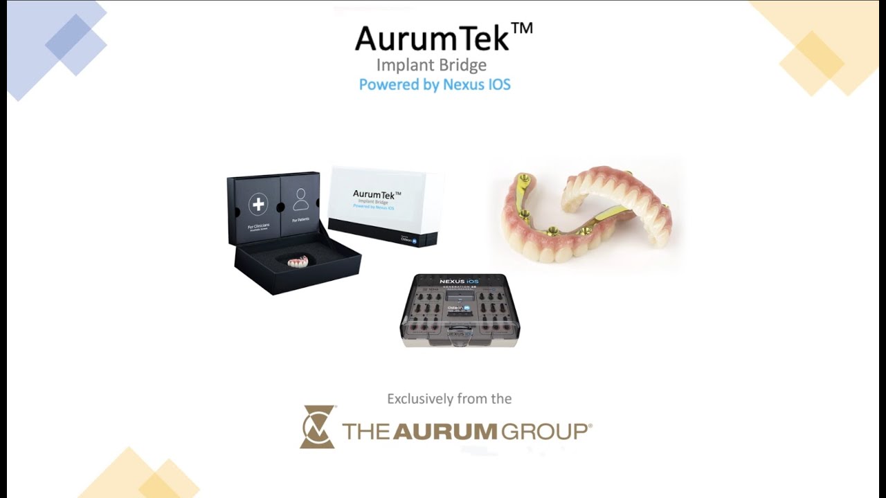 Aurumtek Powered By Nexus Ios Youtube