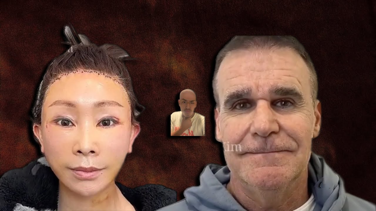 Tiktok Surgeons Are Wild Youtube