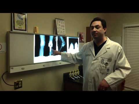 Pinehurst Hip Knee A Tour Youtube
