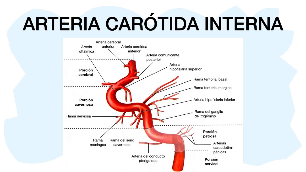 Modelo De Arteria Carotida Interna