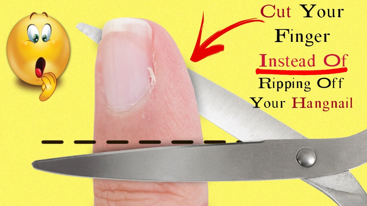 Why You Should Never Rip Off Your Hangnail Youtube
