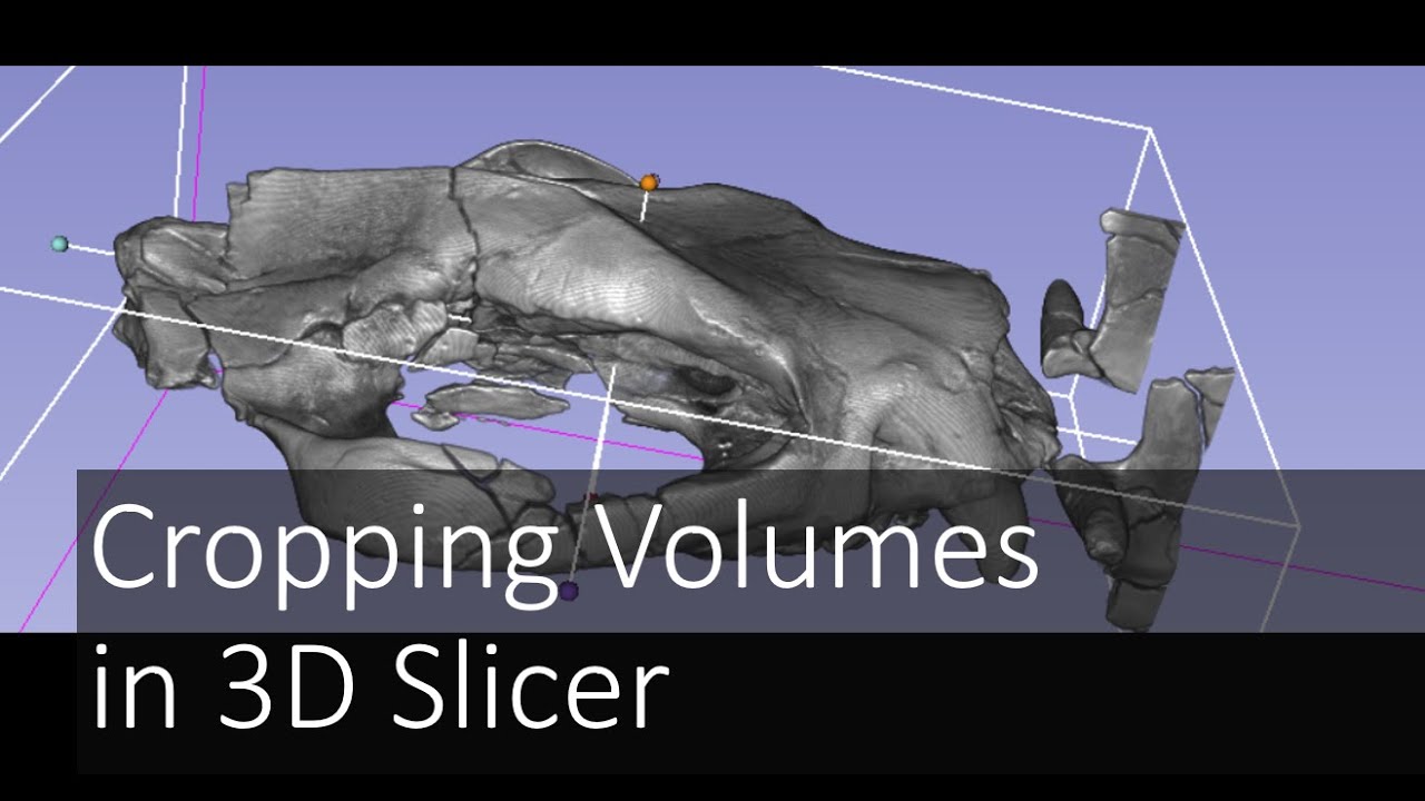 Cropping Volumes In 3d Slicer Introduction To Digital Preparation