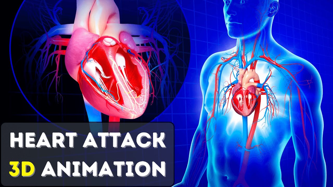 Heart Attack 3d Animation Video Youtube