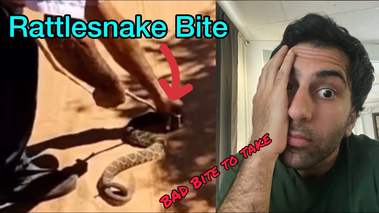 Rattlesnake Bite Reaction Discussion Youtube