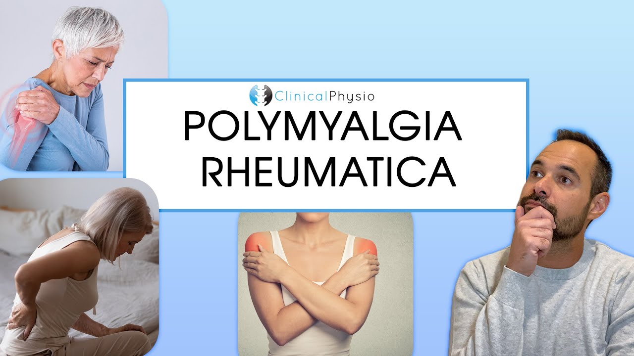 Polymyalgia Rheumatica Diagnosis Ptomo
