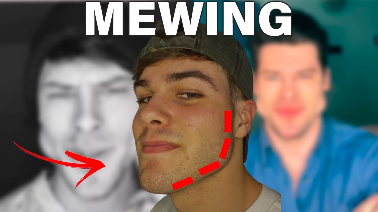 El Mewing Cambio Mi Vida Y La Tuya Como Hacer Mewing Correctamente
