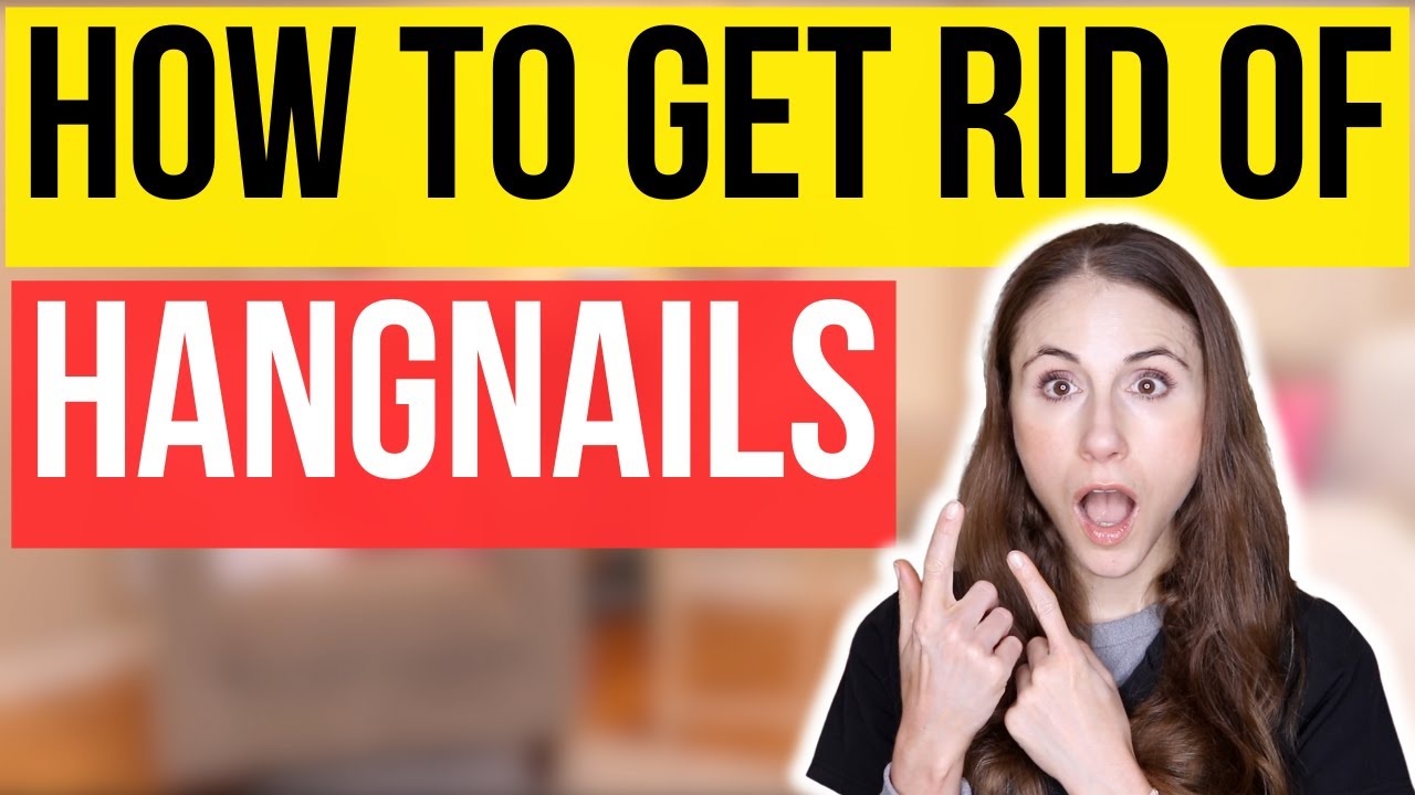 How To Get Rid Of A Hangnail Fast Youtube