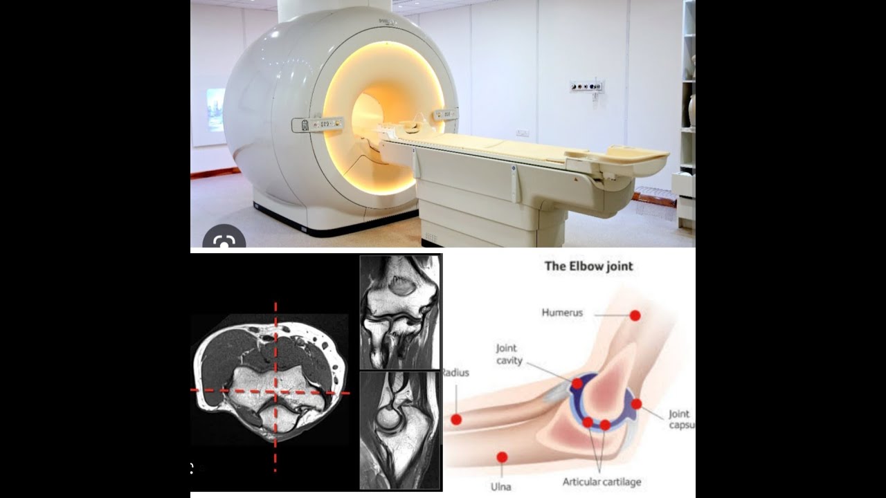 Mri Elbow Joint Planning And Positioning On Philips 3t Youtube