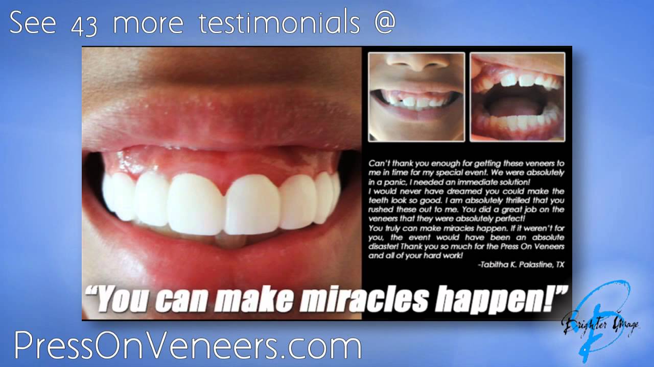 Dental Flipper Before And After Understanding Your Options For