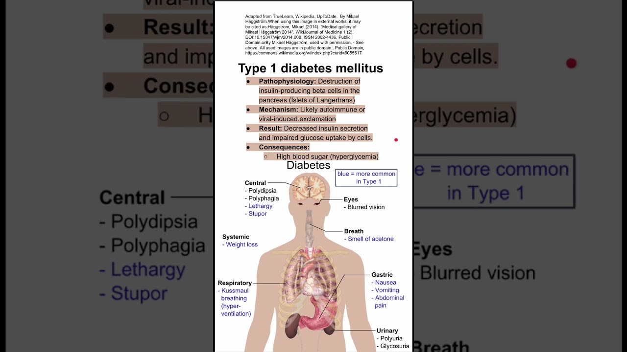 Type 1 Diabetes Mellitus Diabetes