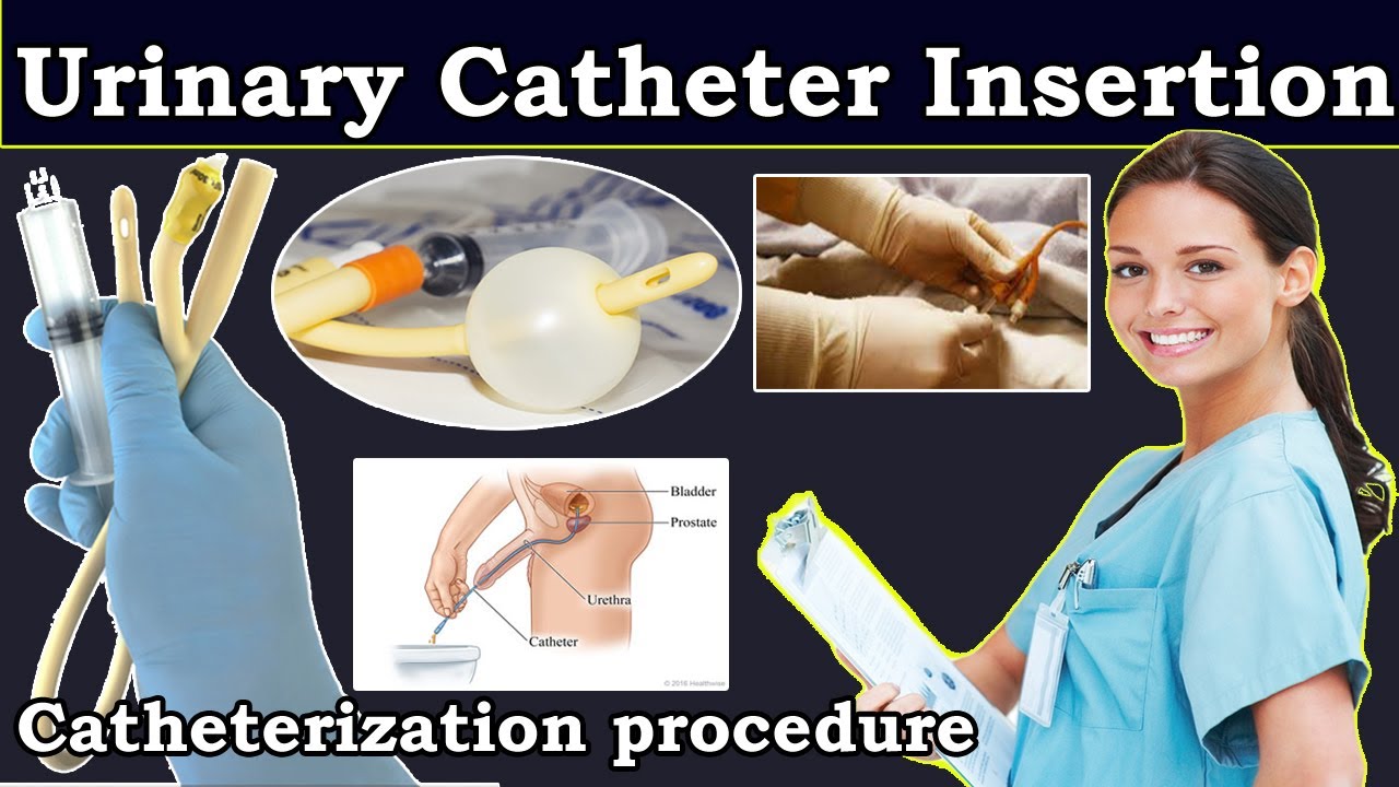 How To Place Urinary Catheter In Female Cat At Terry Summers Blog