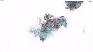 E Coli Bacteria Lysis Caused By Bacteriophage T4 Nanolive Looking ...