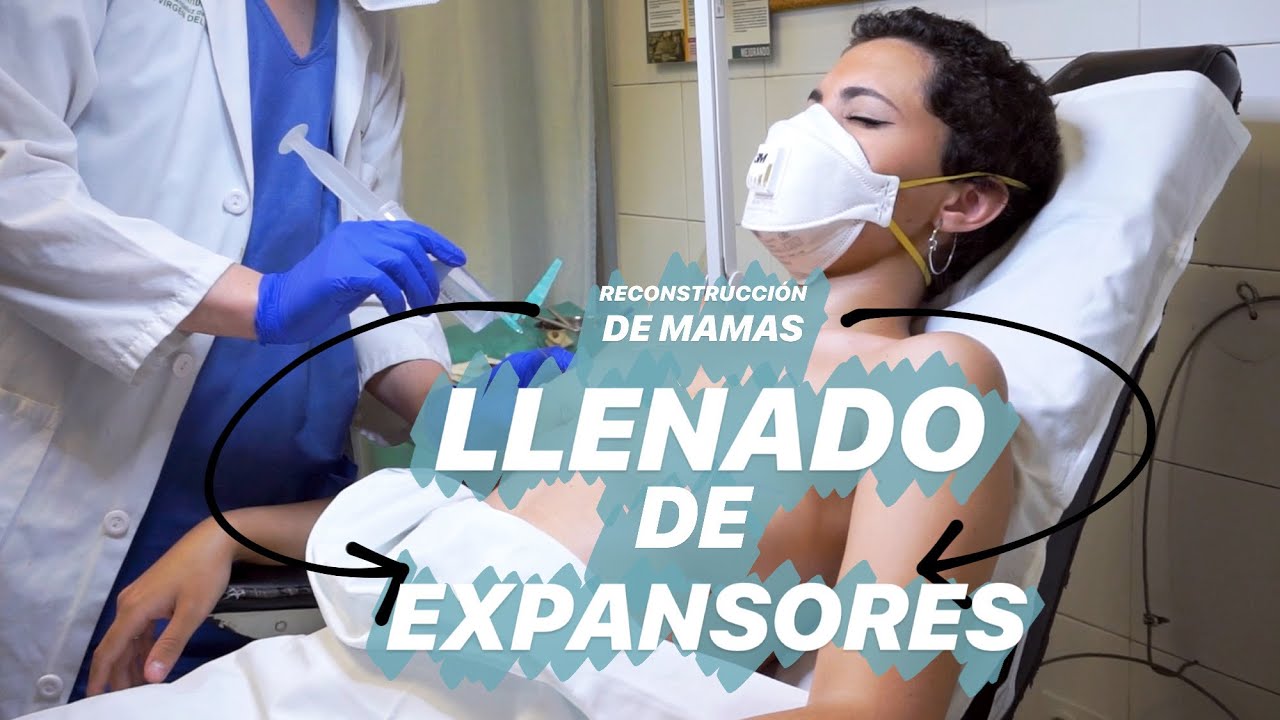 Reconstrucción Tras Mastectomía Llenado De Expansores Cáncer De