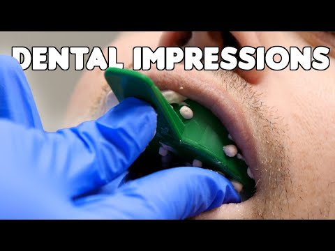 Why Do Dentist Take Impressions