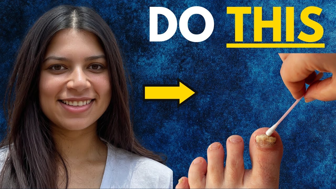 Is Your Toenail Falling Off Here Are The Reasons Why And What You