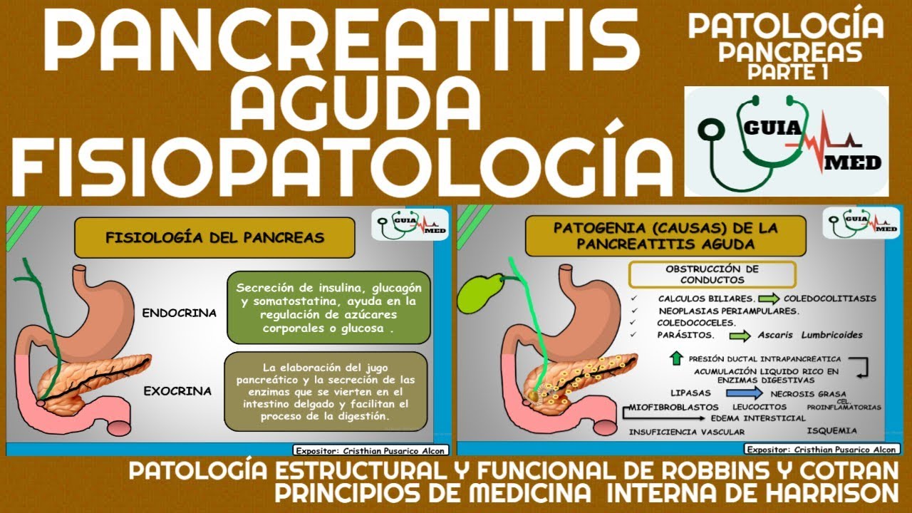 Pancreatitis Aguda Fisiopatología Guiamed Youtube