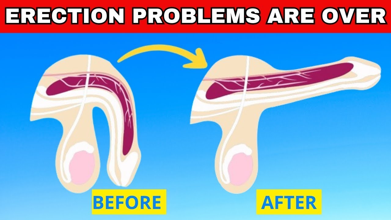 4 Vitamins That Will Revolutionize Your Erection Problems Dr Barbara
