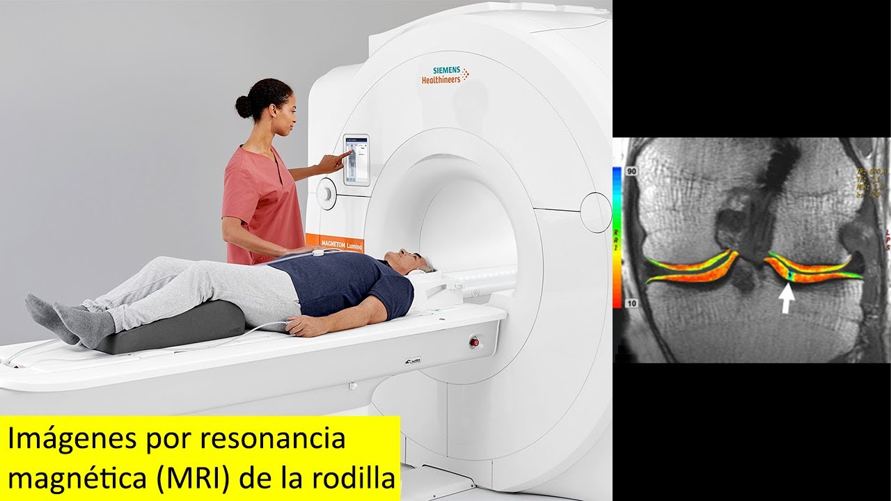 Imágenes Por Resonancia Magnética Mri De La Rodilla Youtube