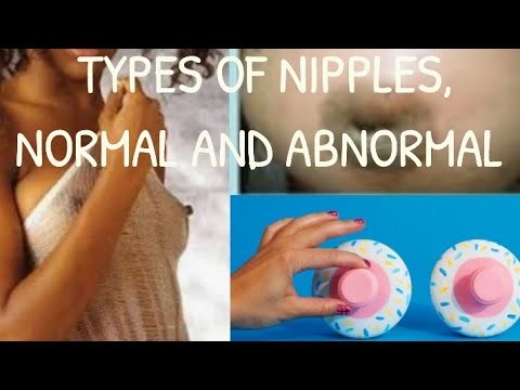 Normal And Abnormal Types Of Nipples Youtube