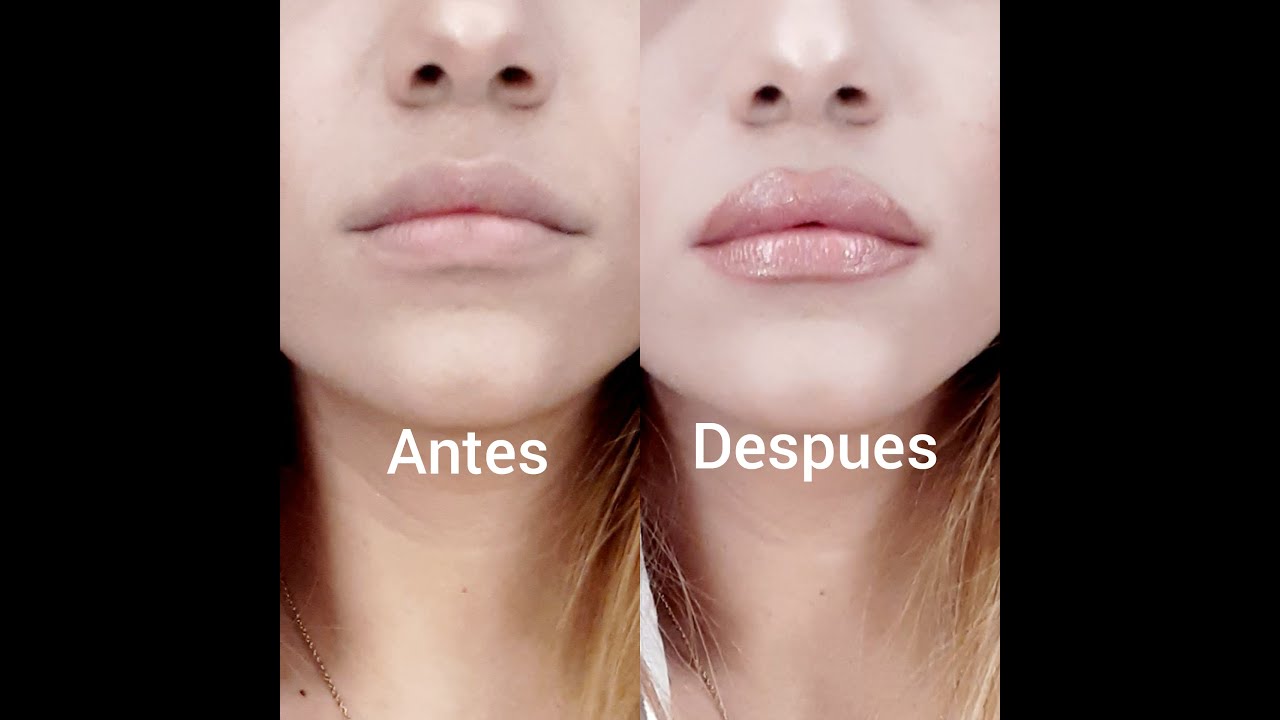 Labios рџ Grandes En Solo Tres Pasos Super Mega Fгўcilesрџ Youtube
