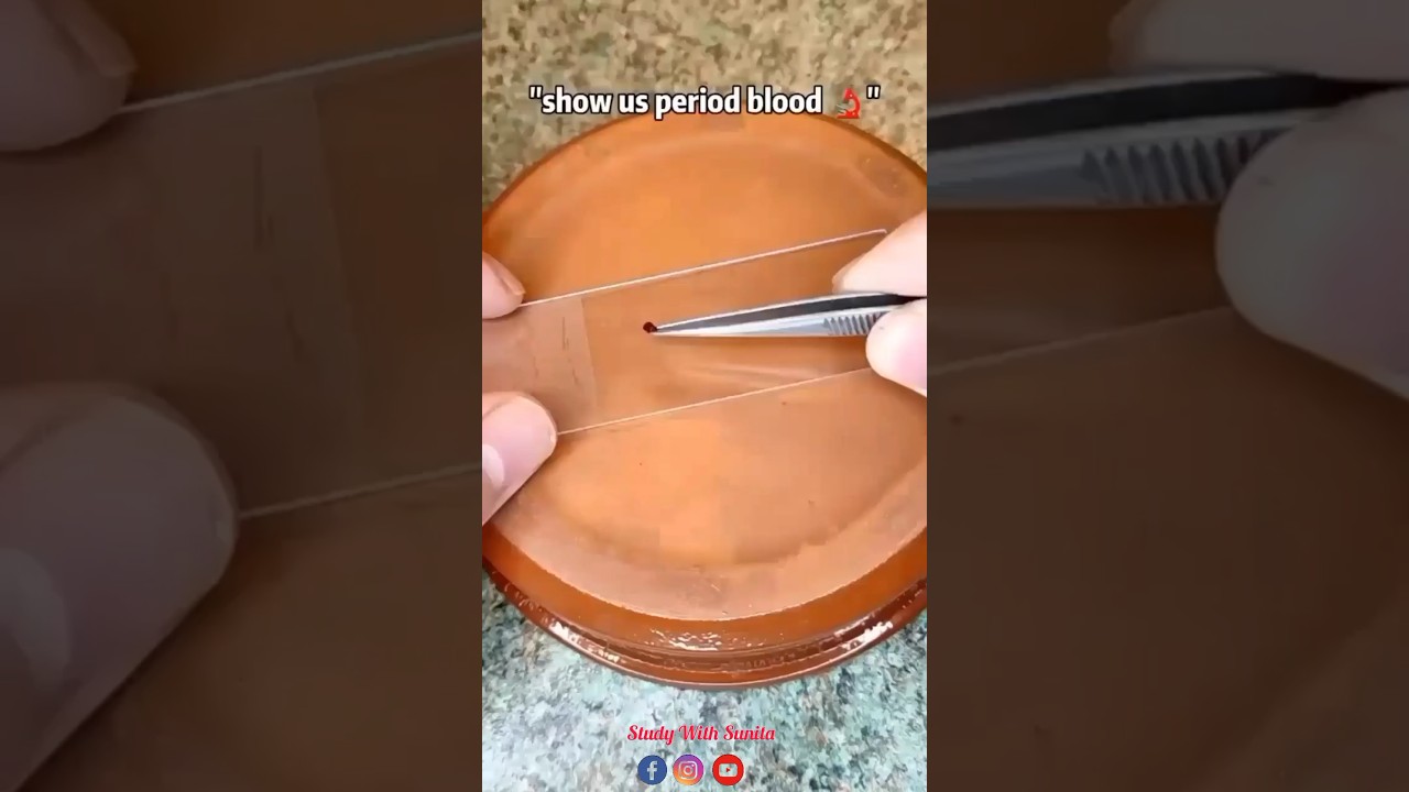 Menstrual Blood Under The Microscope Period Blood Under The
