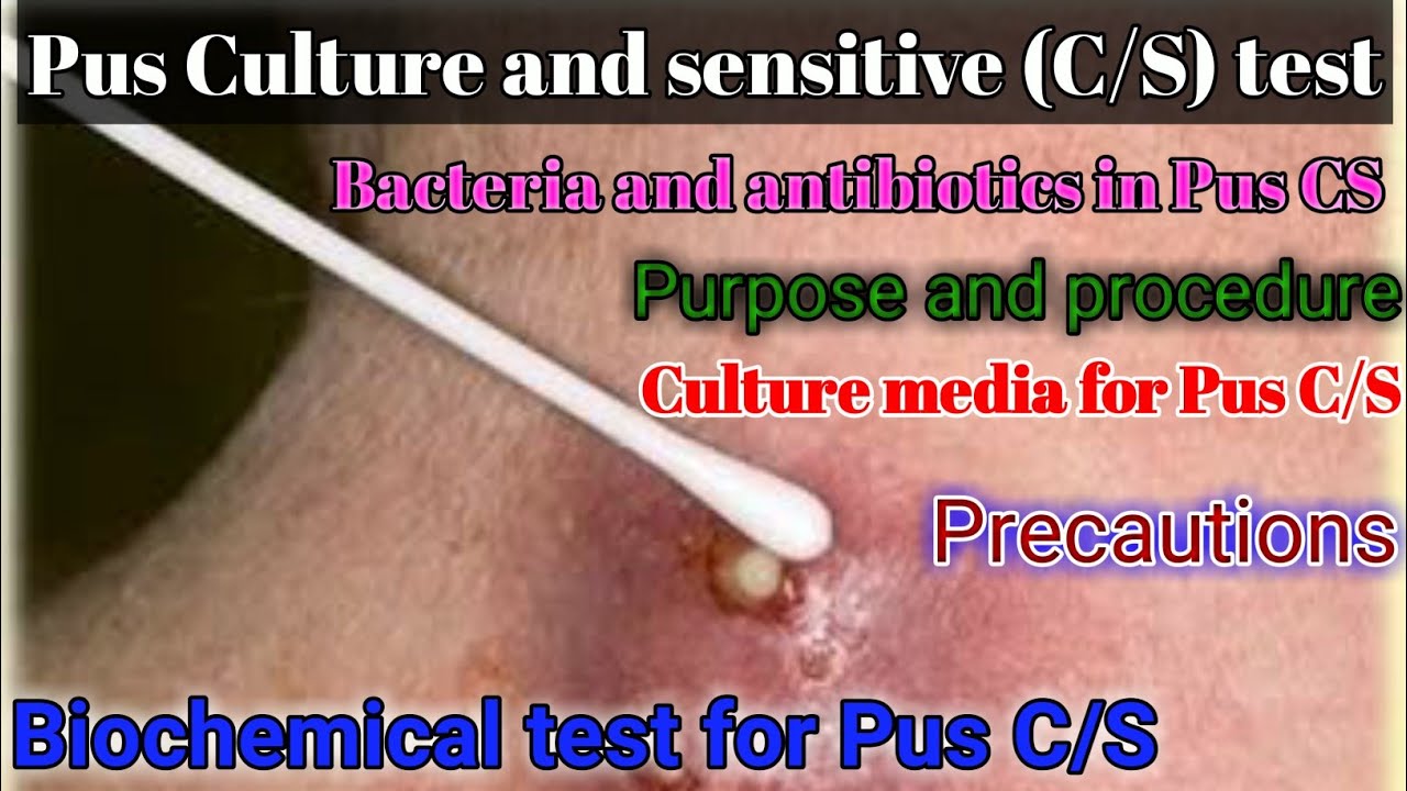 Pus Culture And Sensitivity C S Test Full Explained Youtube