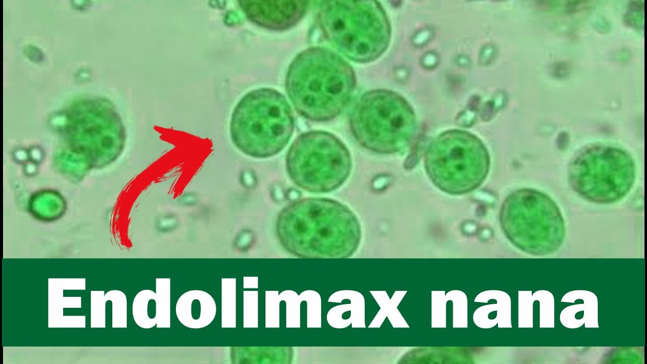 Endolimax Nana Visto Ao Microscópio óptico Identificando Cistos De