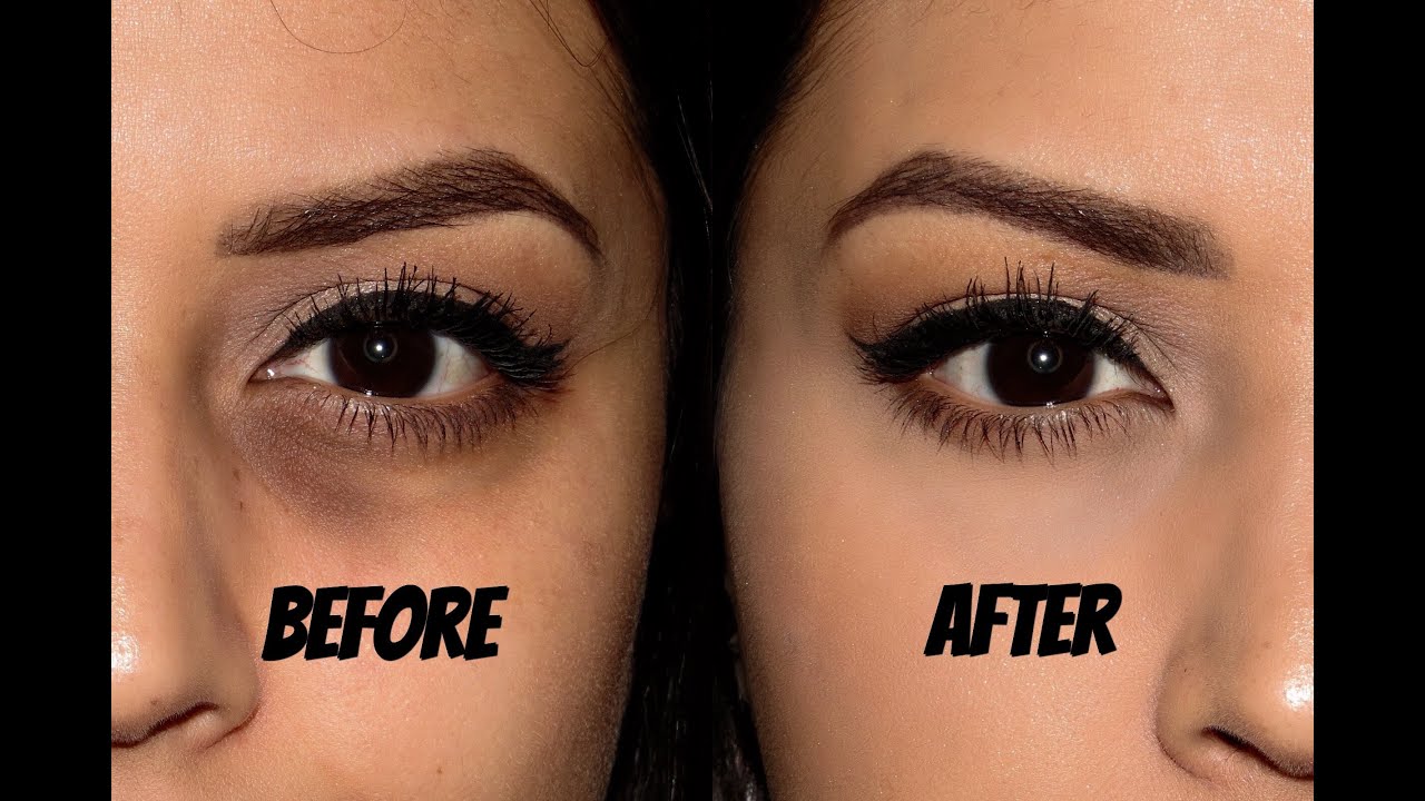 Simple Makeup Tips For Dark Circles Saubhaya Makeup
