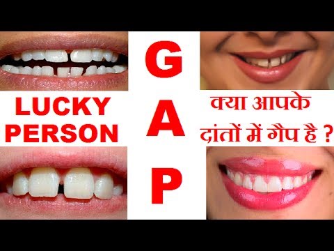 Is There Gap Between Your Teeth Youtube