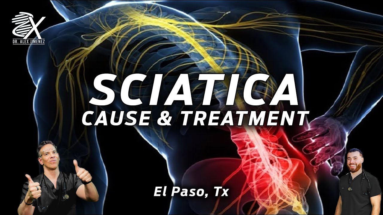 Sciatica Causes Treatments El Paso Tx 2023 El Paso Tx