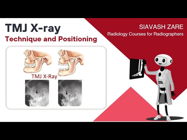 Tmj X Ray