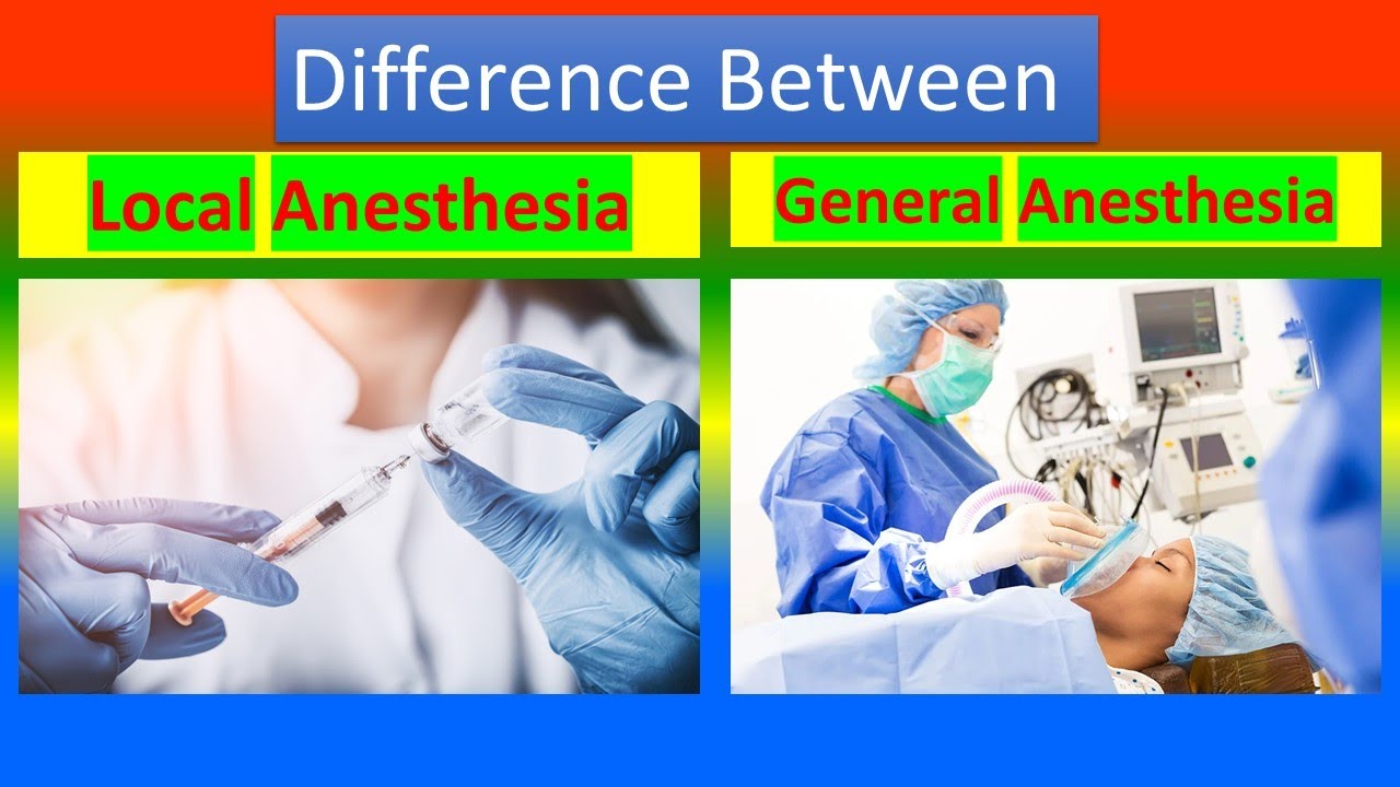 Difference Between Local Anaesthesia And General Anaesthesia Youtube
